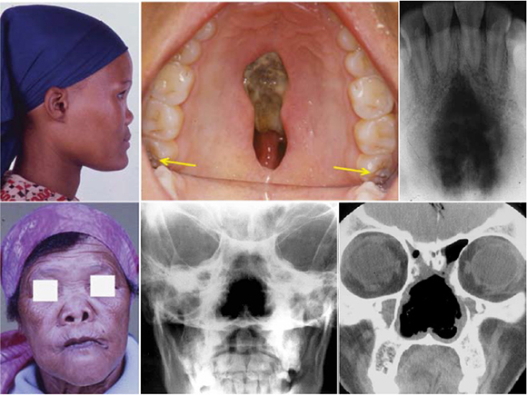 Maxillo-facial radiology case 125