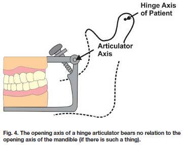An evidence-based guide to occlusion and articulation. Part 6 ...