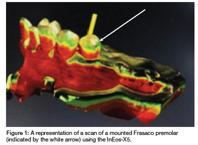 A comparison of the flexibility and fracture point of cast cobalt ...