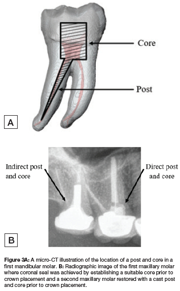 Dentine thicknesses of first molar roots: A review of the literature ...