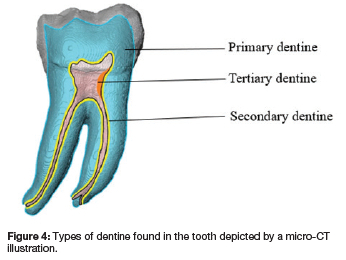Dentine thicknesses of first molar roots: A review of the literature ...