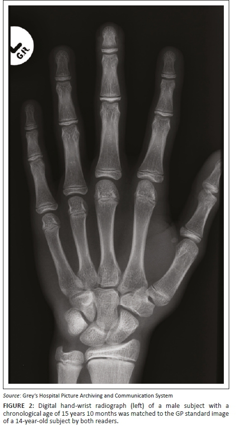 Bone of contention: The applicability of the Greulich-Pyle method for ...