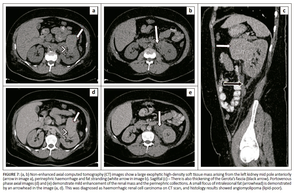 Correlation between radiological and histopathological findings in ...