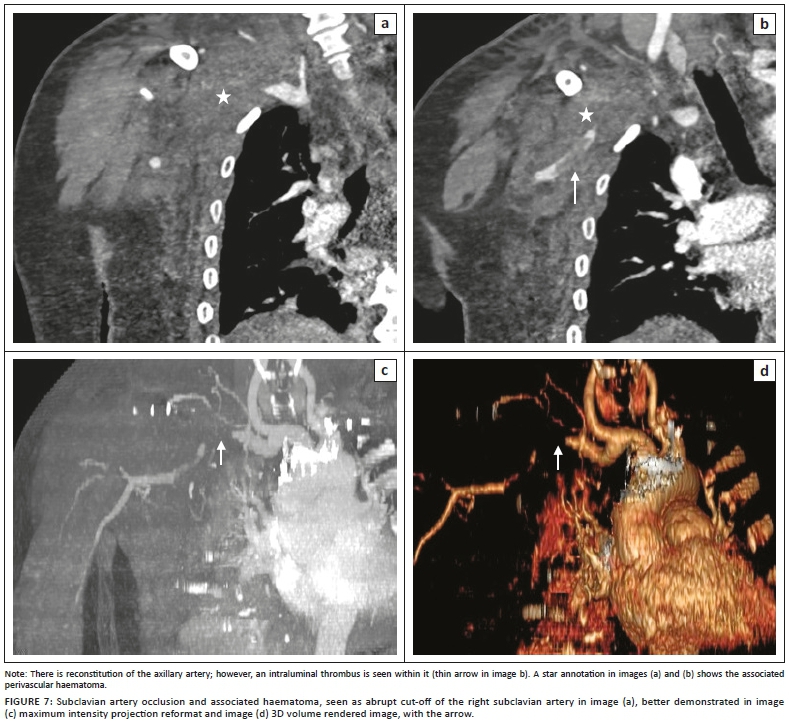 Spectrum of multi-detector computed tomography imaging findings of ...