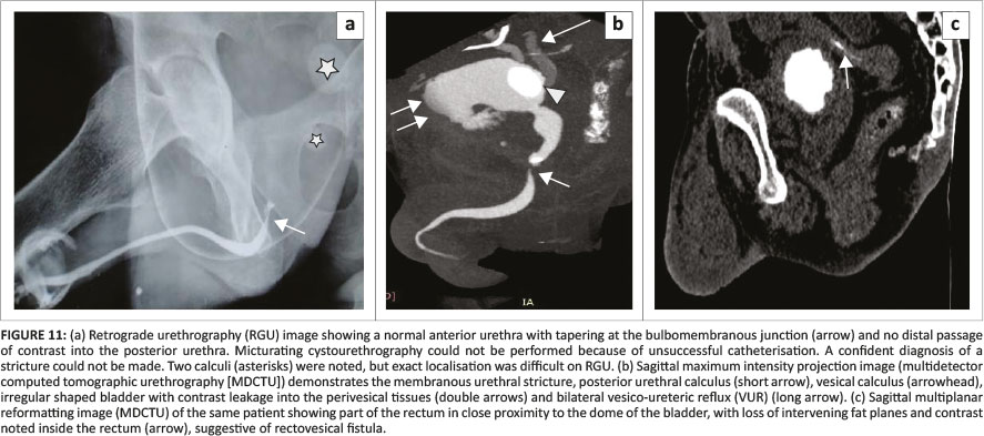 A kaleidoscopic view of male urethral pathologies on 64-slice ...