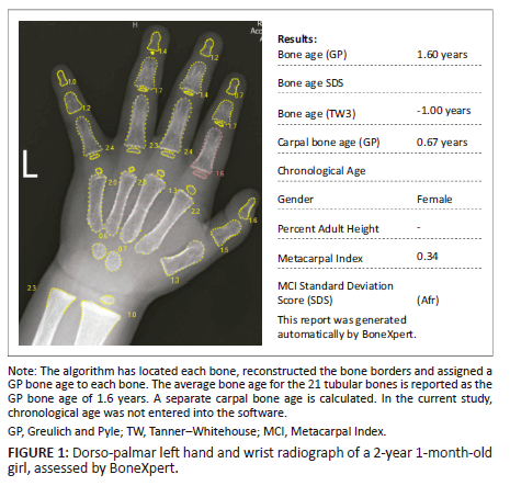 Comparison of bone age assessment using manual Greulich and Pyle method ...