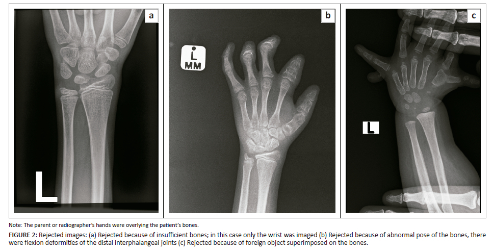 Comparison of bone age assessment using manual Greulich and Pyle method ...