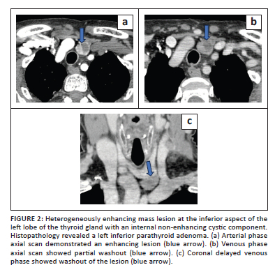 Why? What? When? Utility of 4DCT in the preoperative imaging algorithm ...