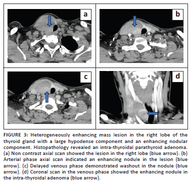 Why? What? When? Utility of 4DCT in the preoperative imaging algorithm ...