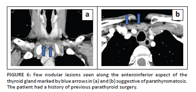 Why? What? When? Utility of 4DCT in the preoperative imaging algorithm ...