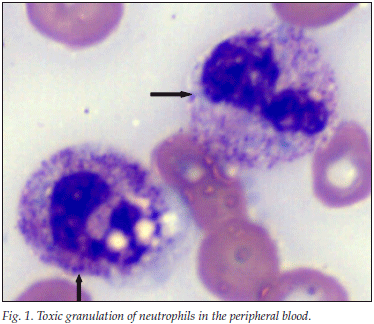 The correlation between C-reactive protein and toxic granulation of ...
