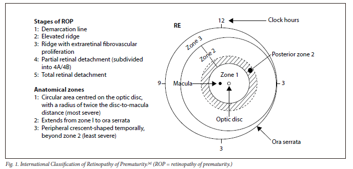 The prevalence, risk factors and outcomes of retinopathy of prematurity ...